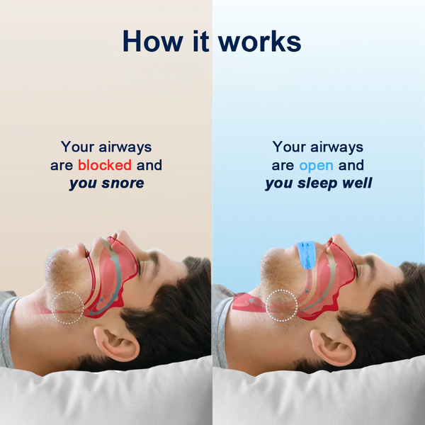 SleepSoothe - End Snoring & Sleep Deeply + 50% OFF TODAY – Isadora
